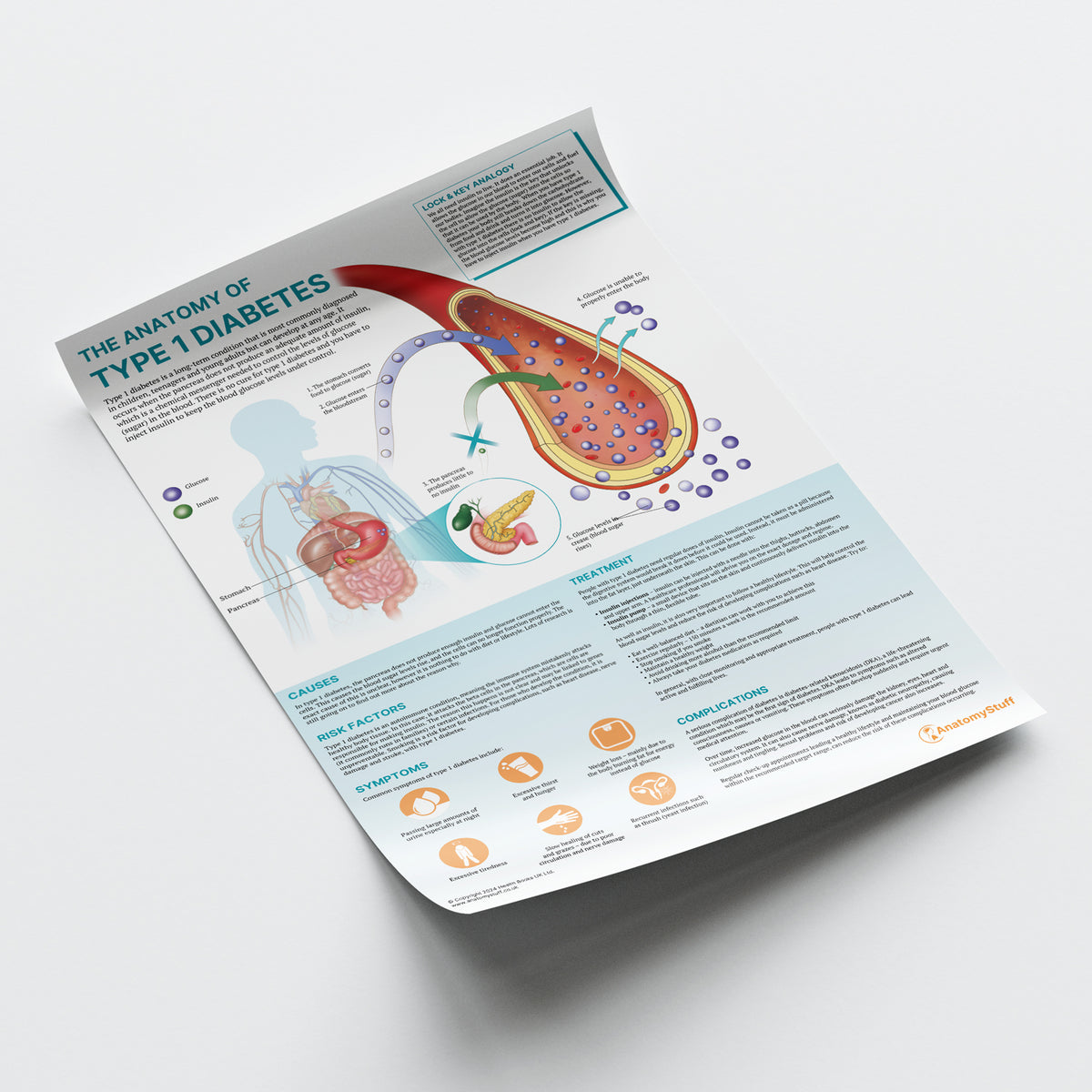 The Anatomy of Type 1 Diabetes Chart/Poster Laminated | Endocrine ...